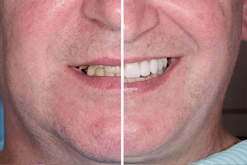 Smile Gallery & Case Studies | Dapto Dentists
