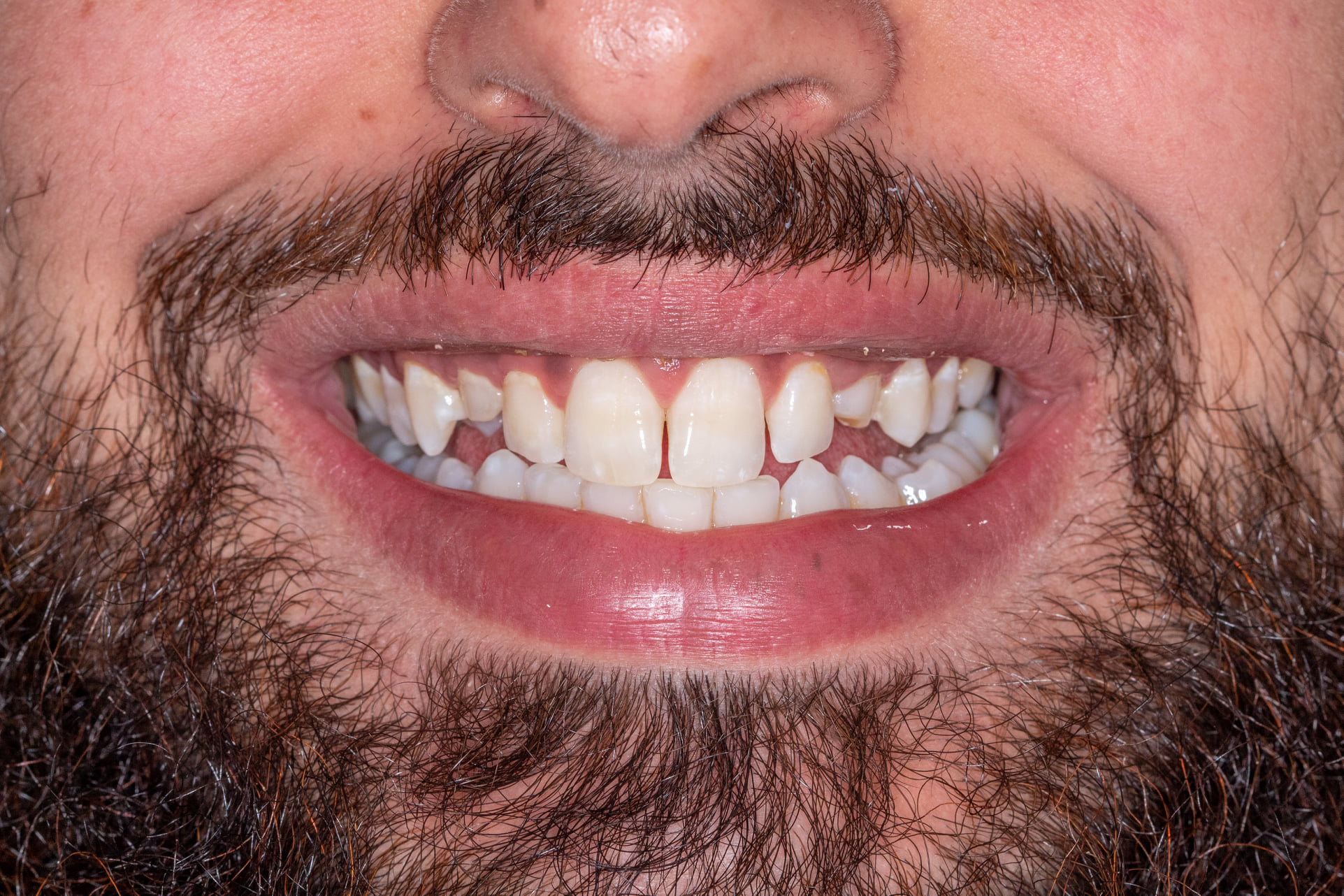 Smile Gallery & Case Studies | Dapto Dentists