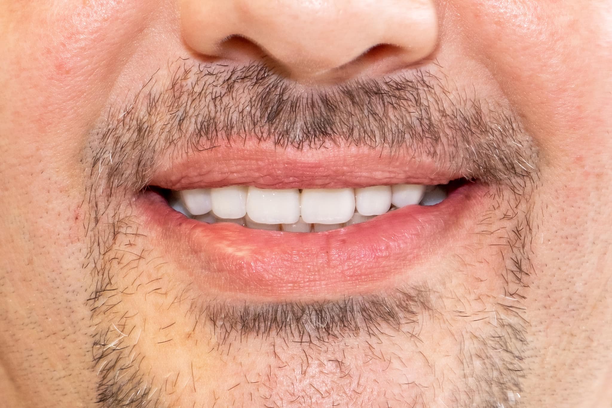 Smile Gallery & Case Studies | Dapto Dentists