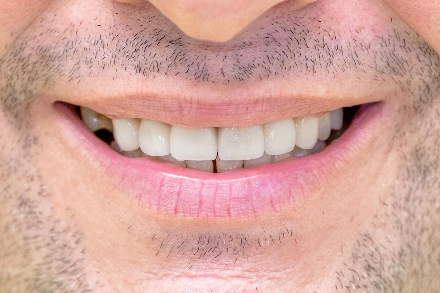 Smile Gallery & Case Studies | Dapto Dentists