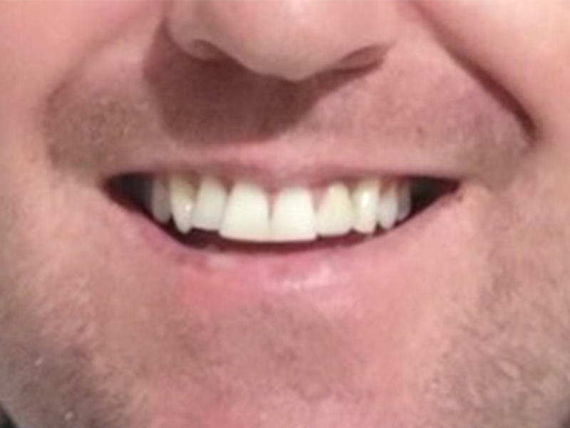 Smile Gallery & Case Studies | Dapto Dentists